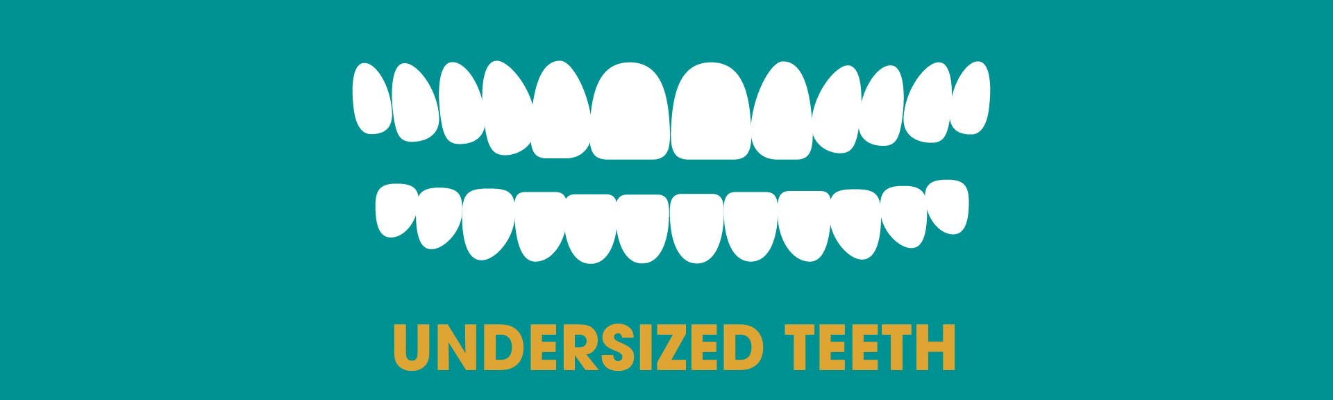 Designing Your Custom Smile with Dental Veneers - The Dentists at Town ...